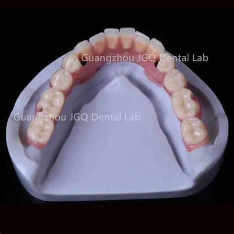 Full Zirconia Crown And Bridge Supported Dental Implants Dental