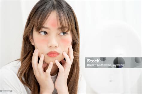 젊은 여성은 얼굴이 피부과 화장품의 스테로이드에 알레르기가 있는지 걱정합니다 민감성 피부 햇볕에 타서 얼굴이 붉어지고 여드름이