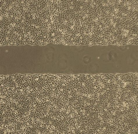 细胞划痕实验详细步骤，手把手教你做！