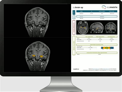 Icometrix Reviews Pricing Features And Integrations Elion