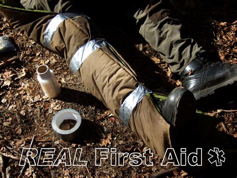 Improvised Inflatable Splint — Real First Aid