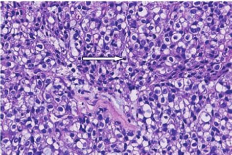 A Large Number Of Different Types Of Cells Were Seen Under The Download Scientific Diagram