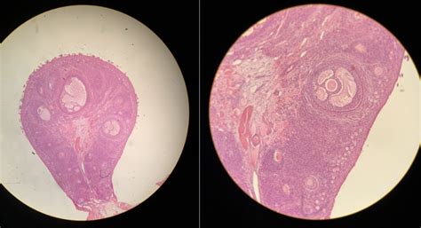 Ovary Slide Diagram Quizlet