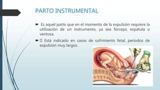 El Parto Y Sus Etapas Pptx