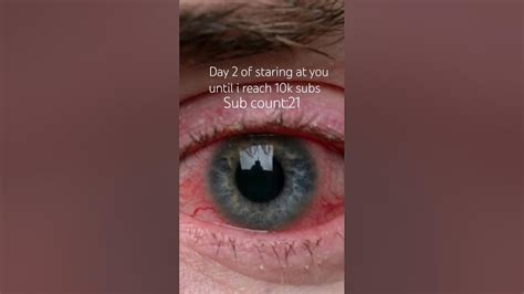 You Can Not Run Youtube