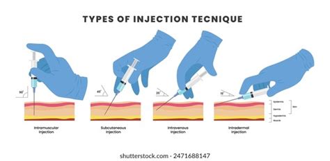 1 602 Technique Doctor Stock Vectors And Vector Art Shutterstock
