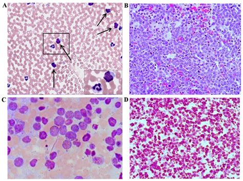 Molecular And Clinical Oncology