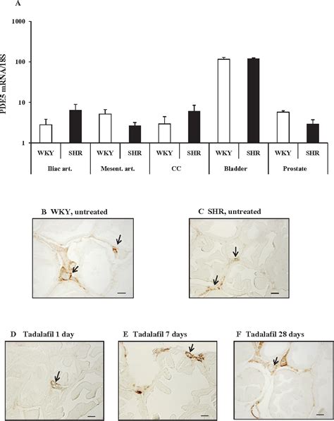 Structure Of Inferior Vesical Artery Semantic Scholar