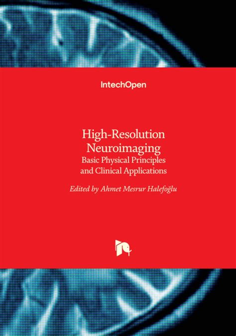 High Resolution Neuroimaging Basic Physical Principles And Clinical Applications Buy Online At