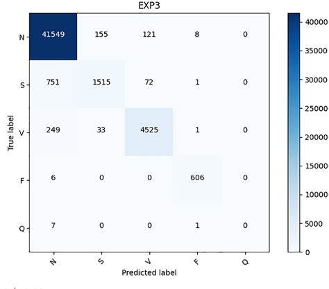 figure 9 from heartbeat classification method combining multi branch