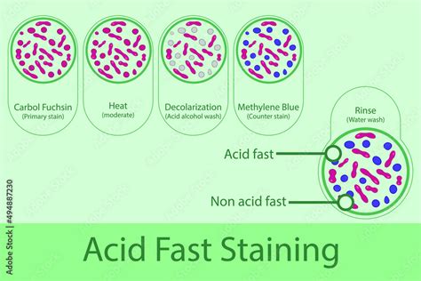 Acid Fast Staining Technique Steps Diagram Using Carbol Fuchsine And Methylene Blue Vector