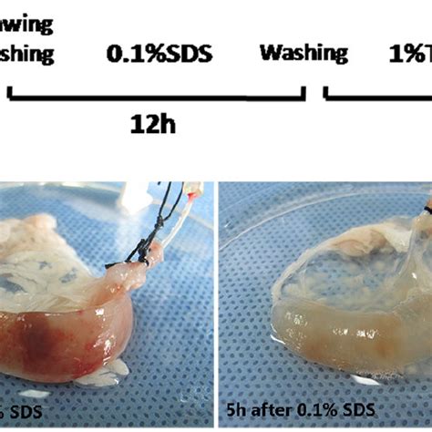 A Schematic Representation Of The Whole Organ Decellularization Download Scientific Diagram