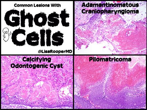 Ghost Cells