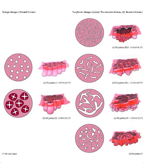 Schematic Representation Of The Crypt Pattern Modified From 89