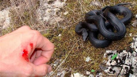 გველის ნაკბენი როგორ გავუწიოთ სწორი პირველადი დახმარება ჯავახეთის საინფორმაციო ცენტრი