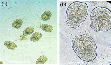 Echinococcus Granulosus Protoscolices At 10× A And 40× B Download Scientific Diagram