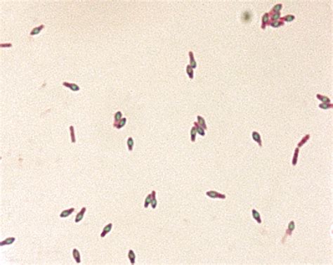 Free Picture Clostridium Botulinum Type Colonies Display Opaque Zone Grown 48hr Egg