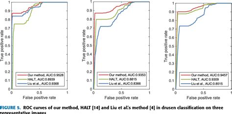 Figure 1 From Drusen Segmentation From Retinal Images Via Supervised Feature Learning Semantic