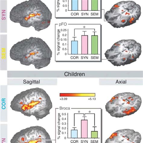 Developmental Increases In Specialization Of Inferior Frontal Gyrus