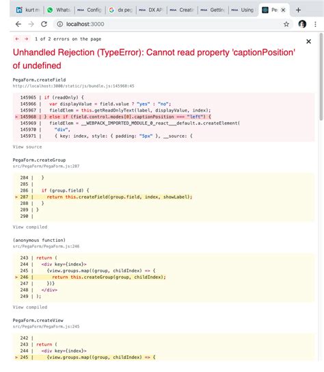 Pega React Starterpack Support Center