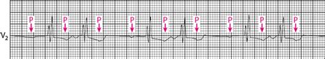 Image Av Block Ii Grades Typ 2 Msd Manual Profi Ausgabe