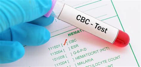 Cbc Blood Test Complete Blood Count Health Street