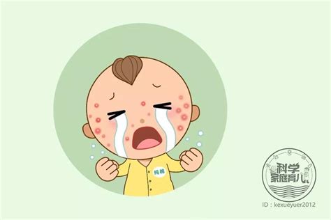 脓疱疹图片丘疱疹包症大山谷图库