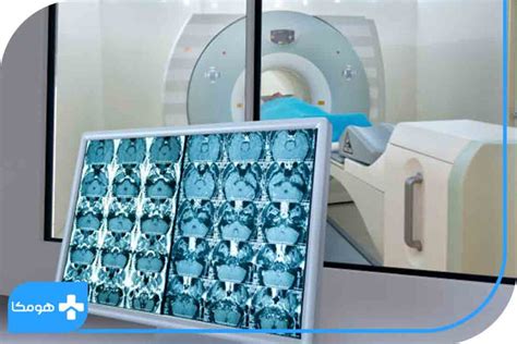 درمان تومور مغزی چیست؟ مجله هومکا