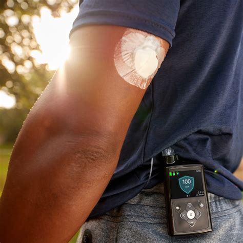 Guardian™ 4 Sensor Diabetes Shop