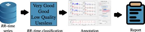Figure 1 From Evaluation Of Two Qrs Detection Algorithm On Ecg Stress