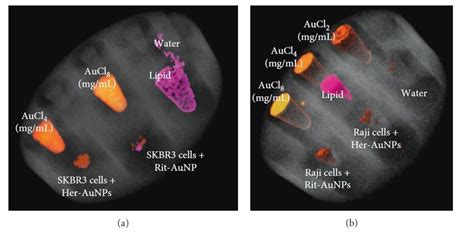 a spectral image based material decomposition method was used to download scientific diagram