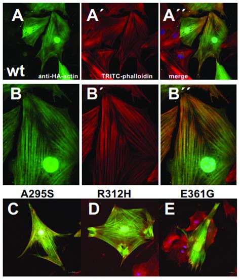 Neonatal Rat Cardiomyocytes Nrc Expressing Ha Tagged C Actin Download Scientific Diagram
