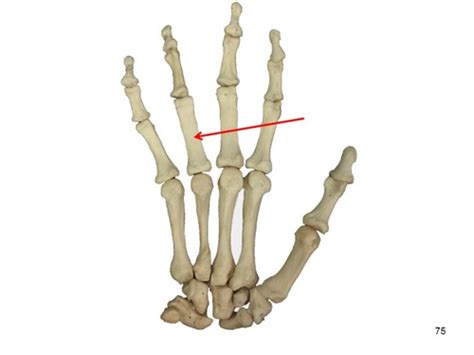 Bio 215 Appendicular Skeleton Lab Pt 1 Flashcards Quizlet