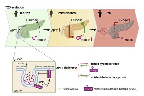 Protein Palmitoylation Helps To Model The Evolution Of Some Forms Of Type 2 Diabetes Diabetes