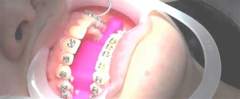 What Is A Depth Perception Test And How To Test It