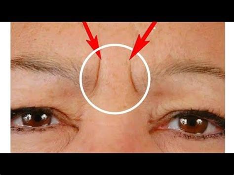 Get Rid Of FROWN LINES NATURALLY Two Effective Massage Techniques Face Yoga Facial Exercises
