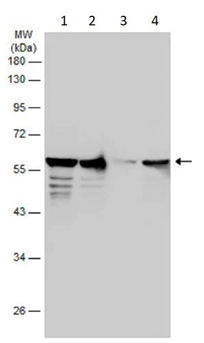 Anti Vimentin Antibody Rabbit Polyclonal Ab137321 Abcam
