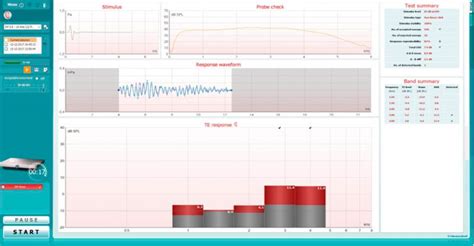 Eclipse Evoked Potentials Device Interacoustics
