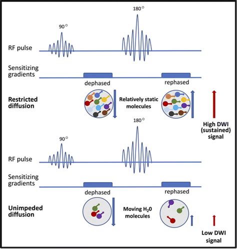 Schematic Illustration Of The Principle Of Diffusion Weighted Sequence Download Scientific Schematic Illustration Of The Principle Of Diffusion Weighted Sequence Download Scientific