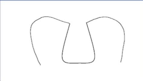 Amalgam Cavity Preparation Flashcards Quizlet