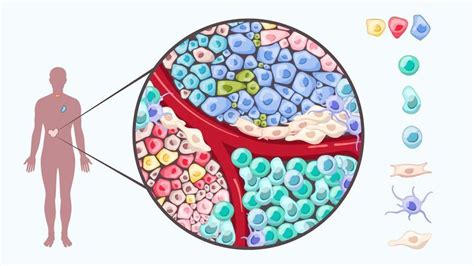 Learn About Tumor Heterogeneity In Cancer Research Clinical Genetics