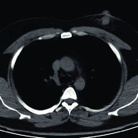 A 34 Year Old Male Patient With A Suspected Malignant Lesion Of