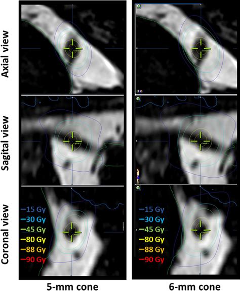 Comparison Of Two Dosimetric Plans For The Same Patient Using The Same Download Scientific