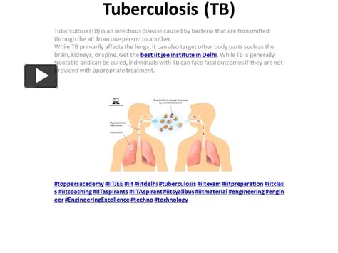 Tuberculosis Tb Presentation Free To Download