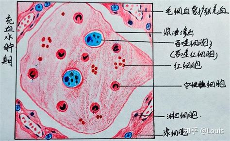 病理报告红蓝铅笔绘图 知乎