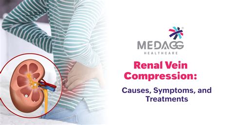 How To Shrink Thyroid Nodules Without Surgery A Comprehensive Guide Medagg