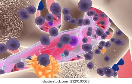 Multiple Myeloma Cellular Level 3d Rendering Stock Illustration