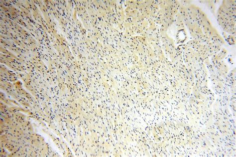 Ca13 Fusion Protein Ag10059 Proteintech