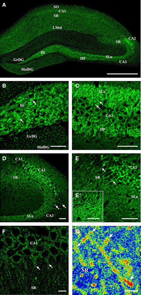 Frontiers Tomosyn Expression Pattern In The Mouse Hippocampus