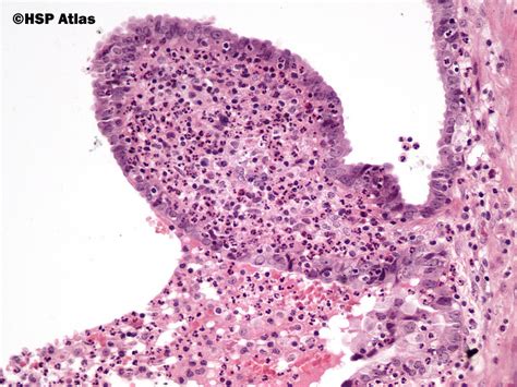 Hsp Atlas Histopathology Atlas Reproductive